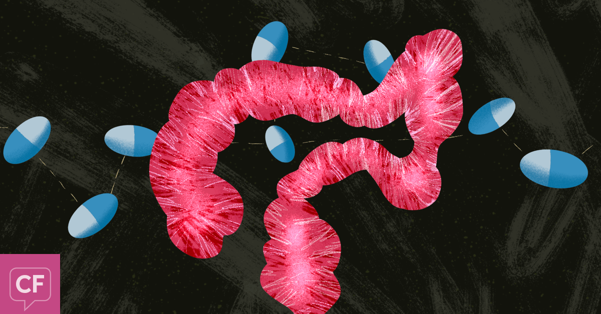 An Overview of Fibrosing Colonopathy in Cystic Fibrosis